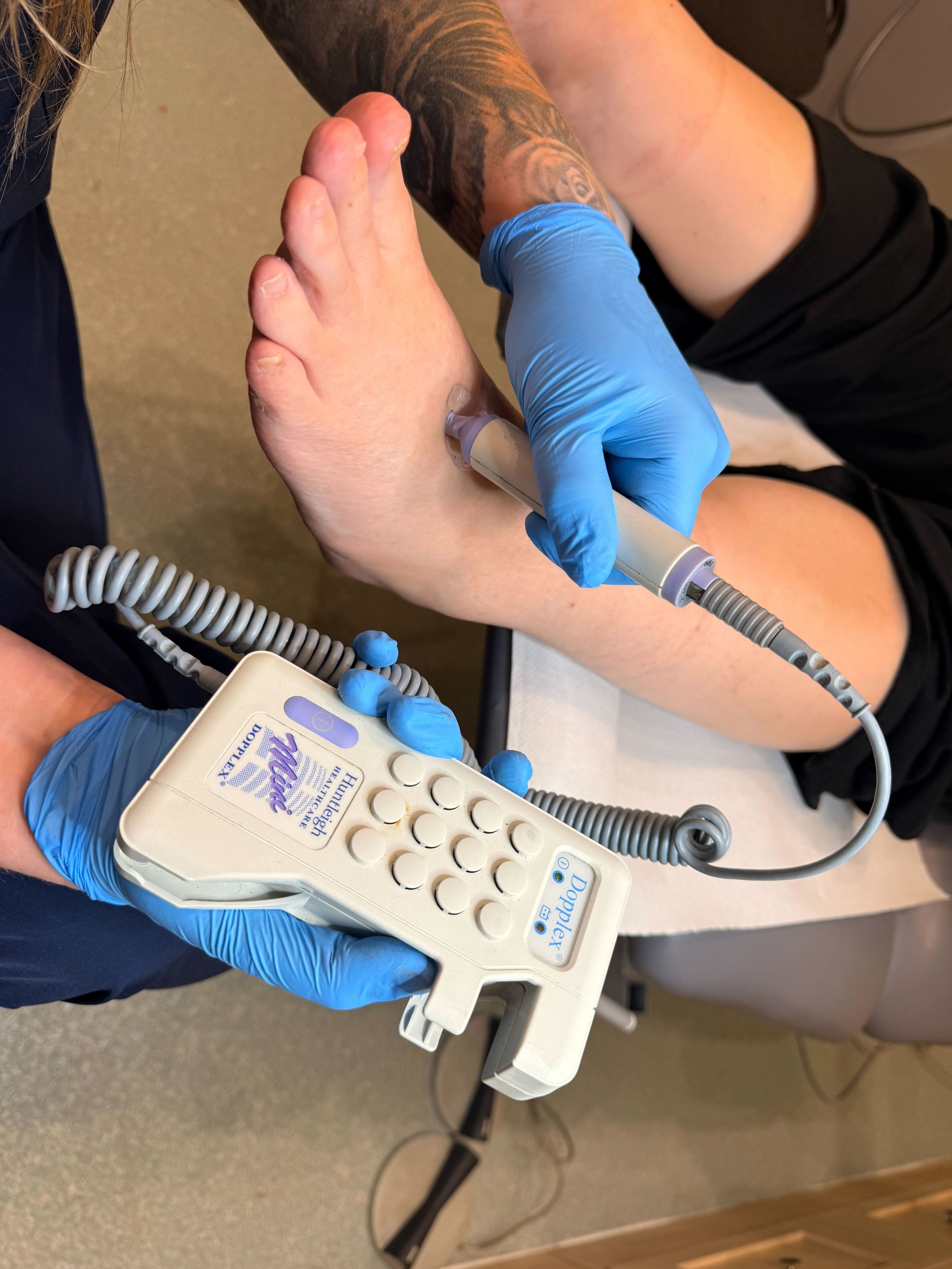 Diabetic Foot Treatment London | Flawless Feet