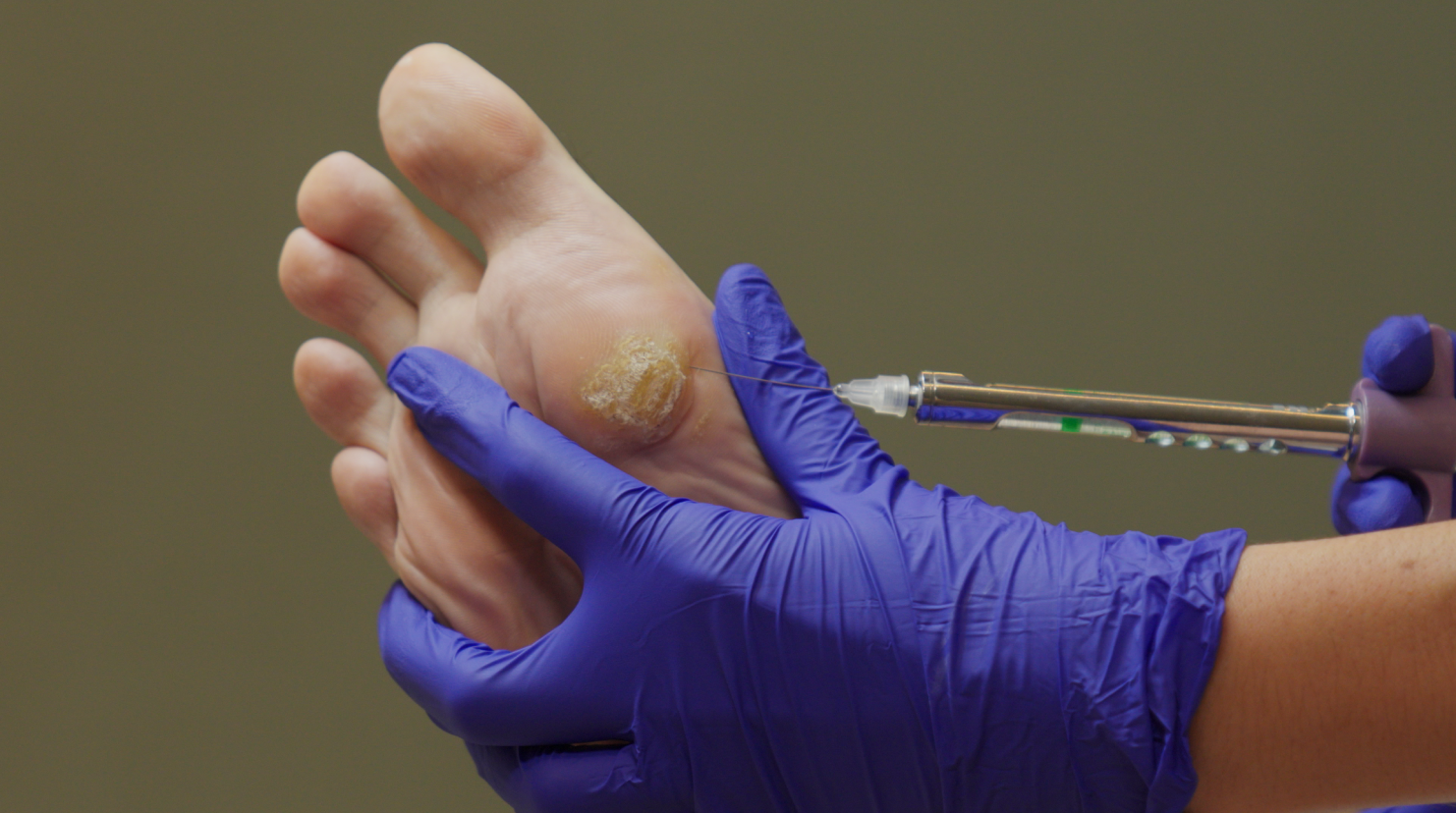 Flawless Feet London | Expert Podiatry and Chiropody Services for ...